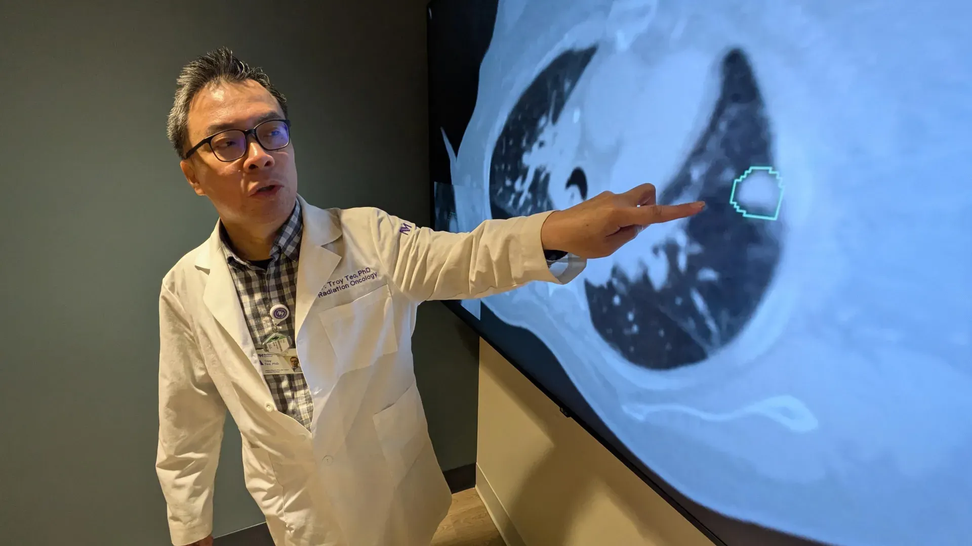 AI Tool iSeg Revolutionizes Lung Tumor Mapping for Radiation Therapy