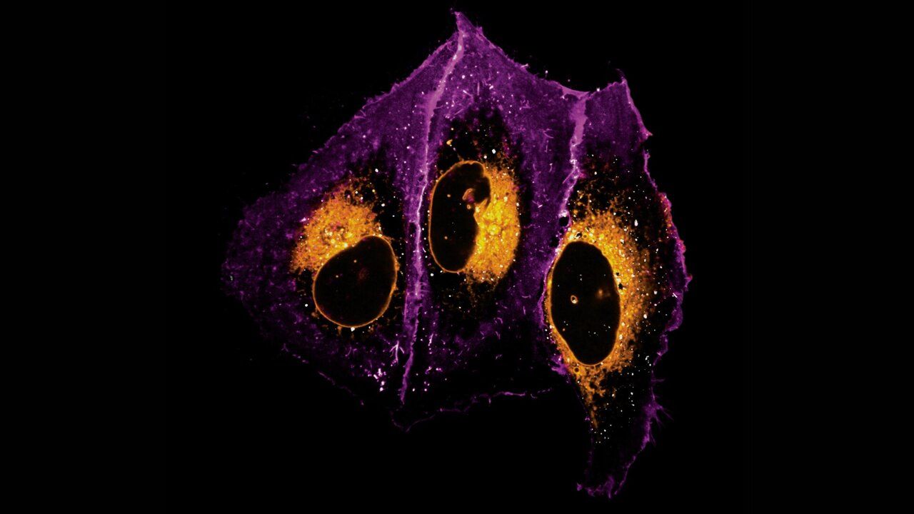 Breakthrough in Lipid Imaging: New Method Reveals Rapid Protein ...