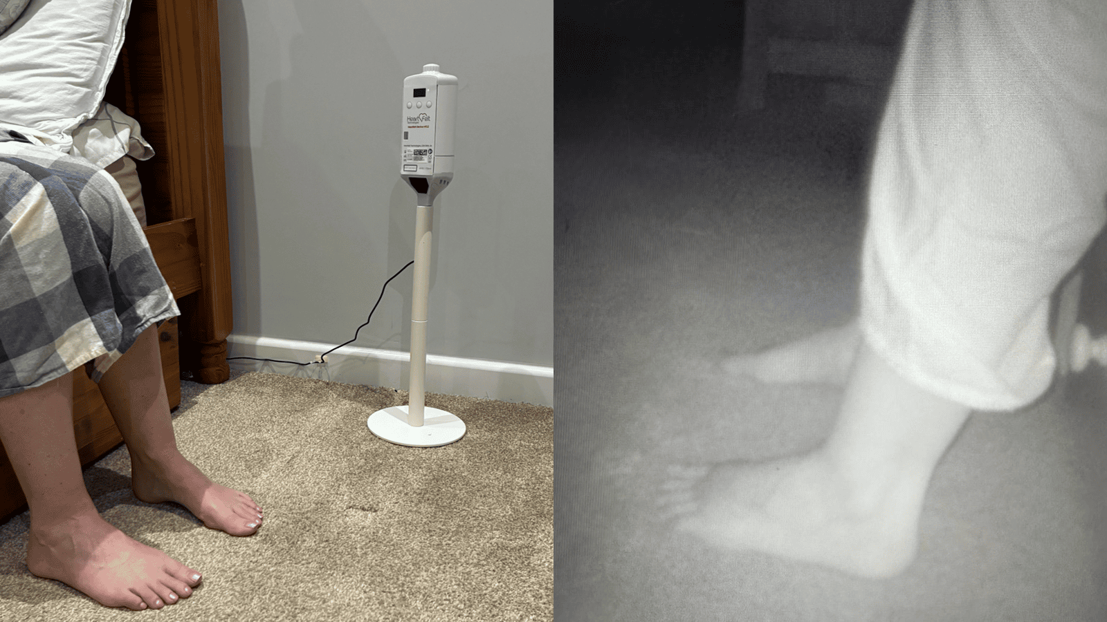 AI-Powered Foot Scanner Detects Early Signs of Heart Failure ...
