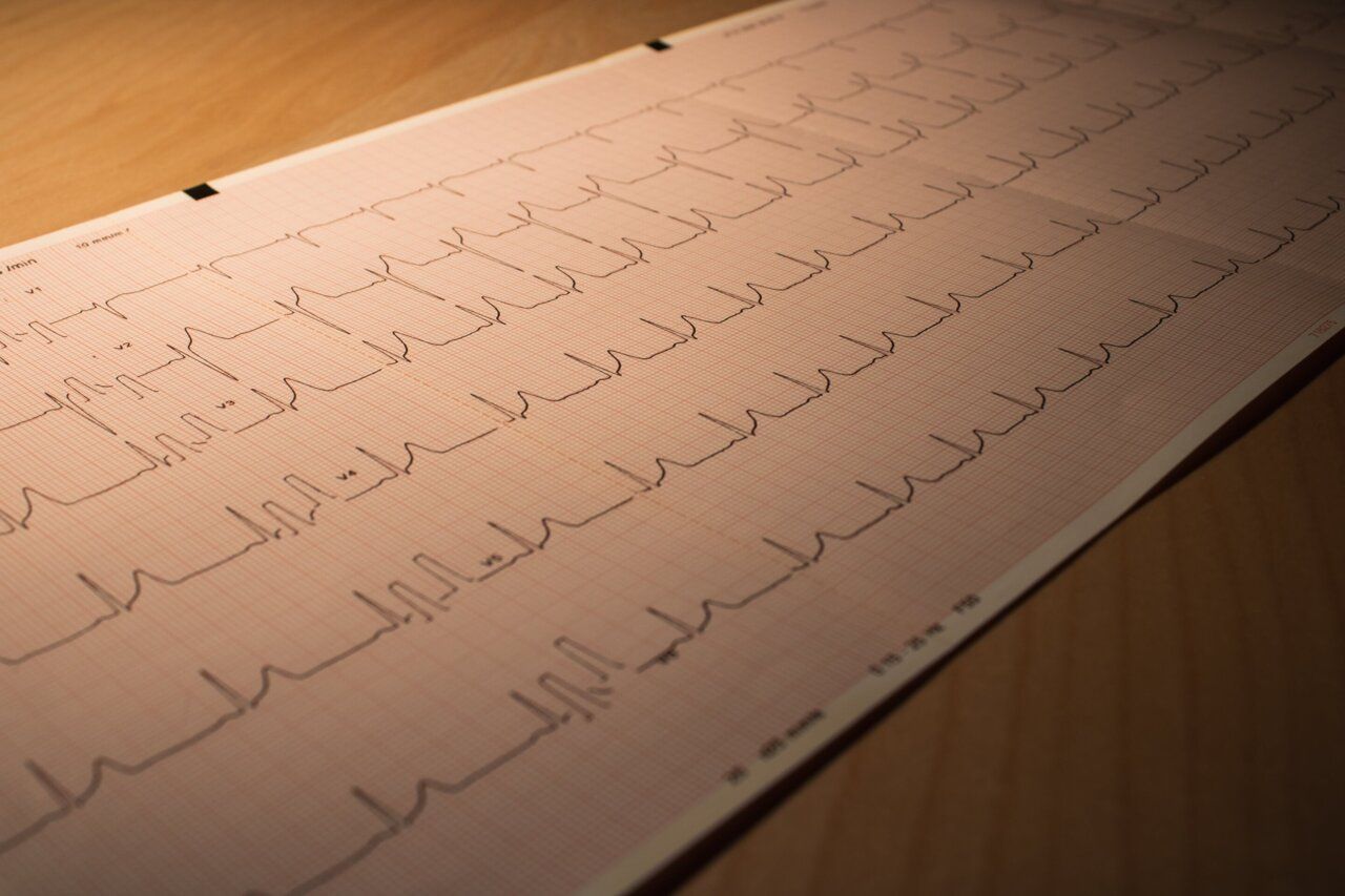 Yale Researchers Develop AI Tool for Rapid and Accurate Echocardiogram ...