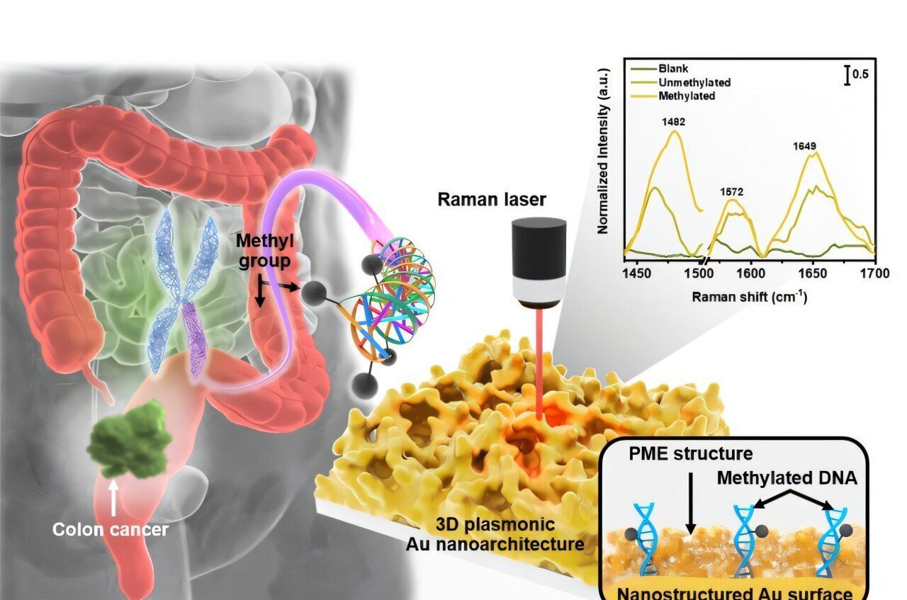 Revolutionary AI-Powered Biosensor Enables Early Cancer Detection Using ...