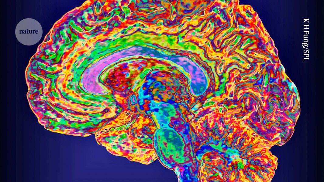 Brain Implant Decodes Inner Speech with Password Protection, Advancing AI-Powered Communication