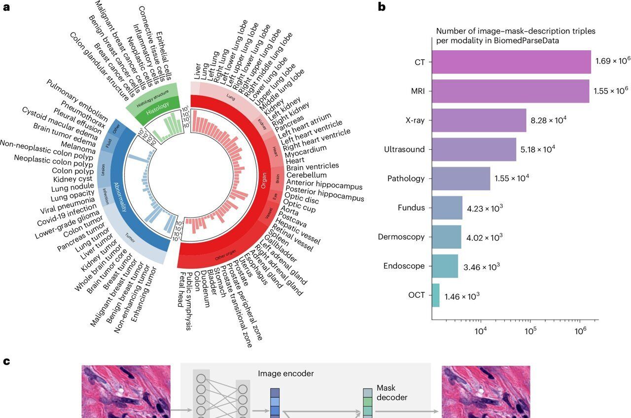 BiomedParse: A Breakthrough AI Model for Analyzing Multiple Medical ...