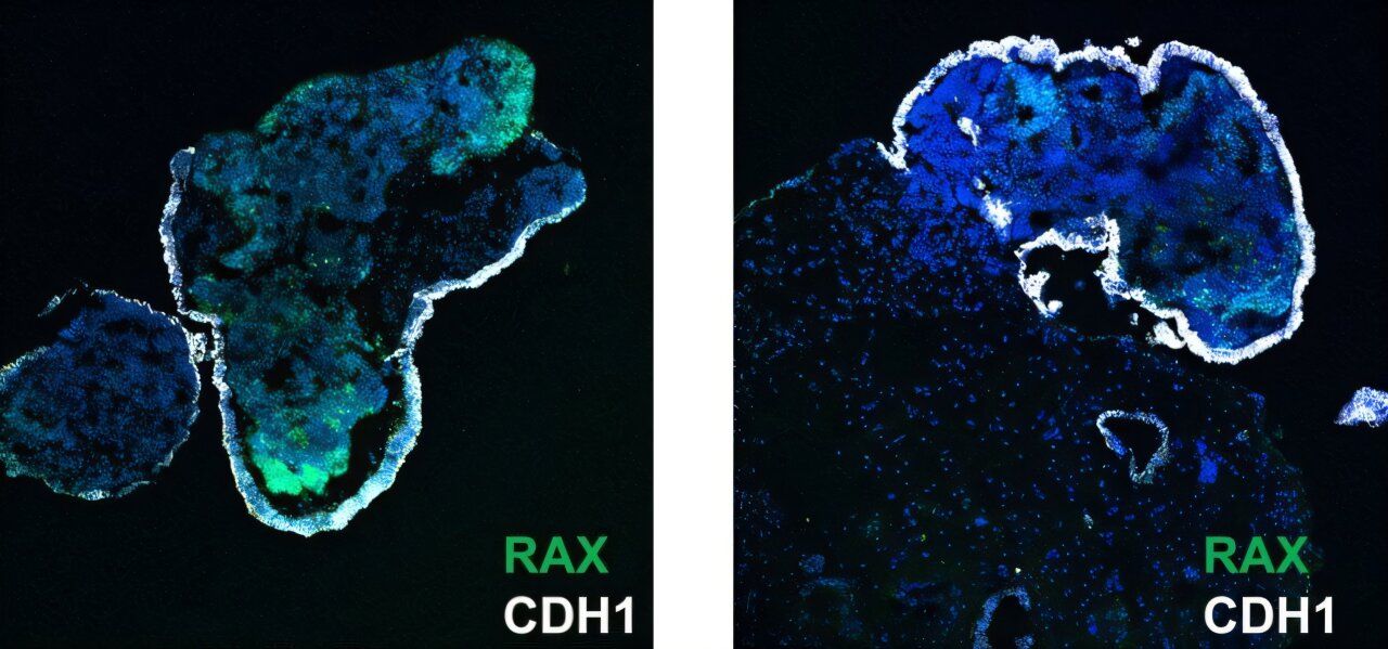 AI Outperforms Experts in Predicting Quality of Lab-Grown 'Mini-Organs'